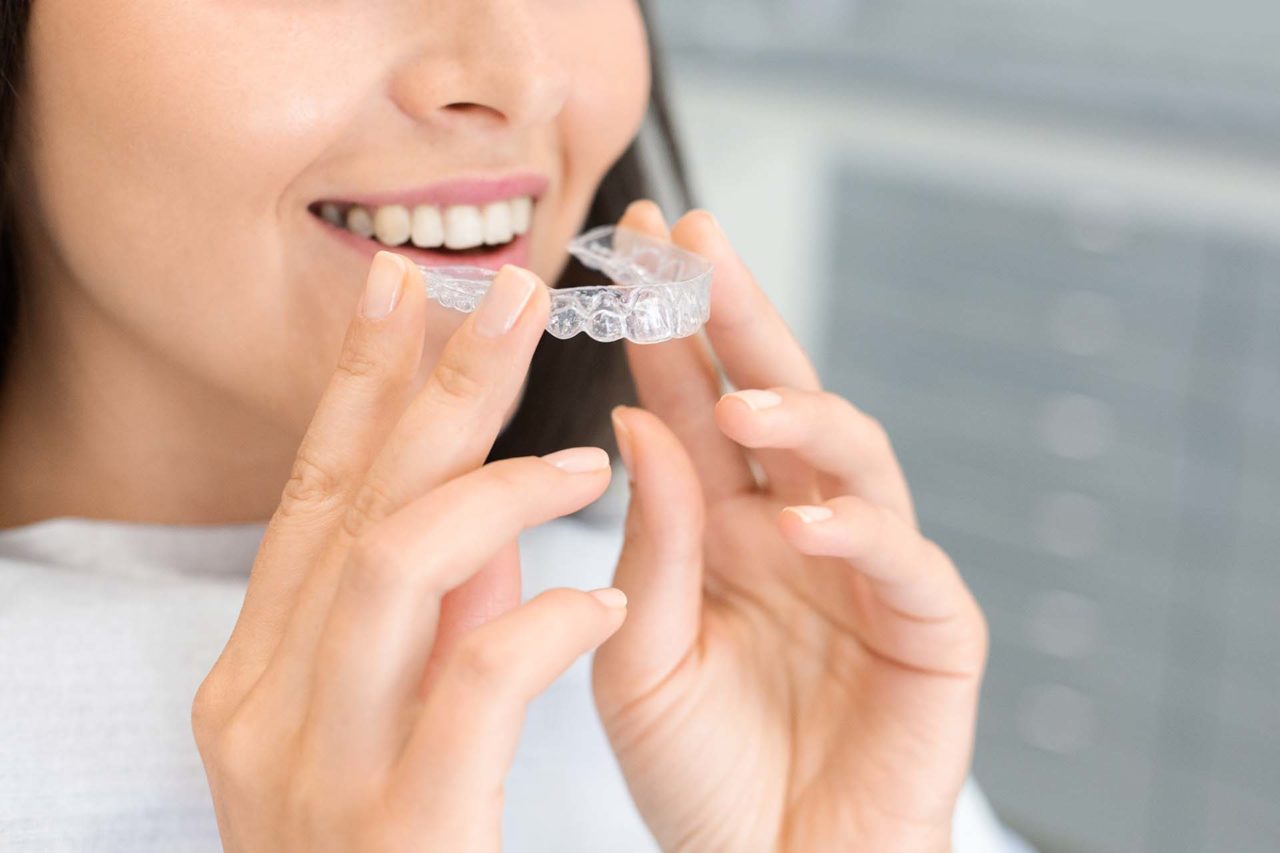 Invisalign Clear Aligners in Chicago, Northbrook, & Glencoe